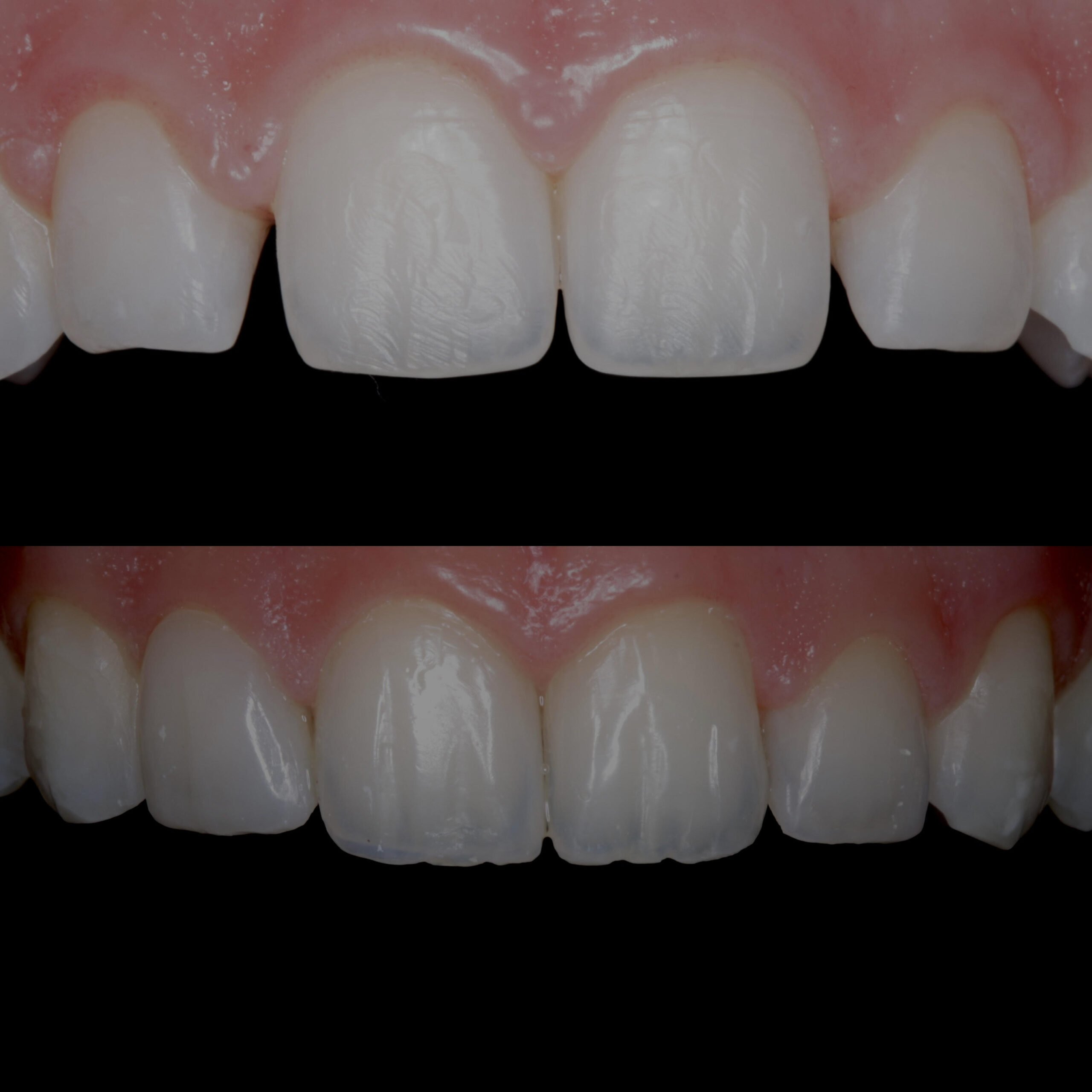 Αισθητική Οδοντιατρική - Dr.Ortho Clinic